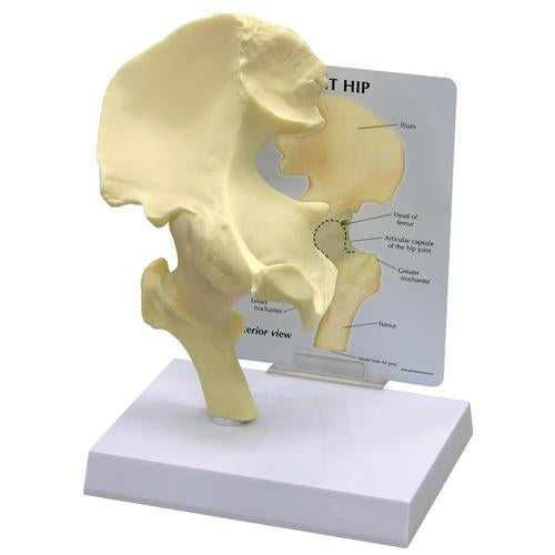 Individual Bone Models — Health Simulation