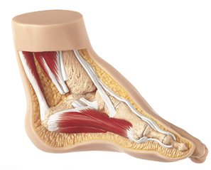 Club Foot — Health Simulation