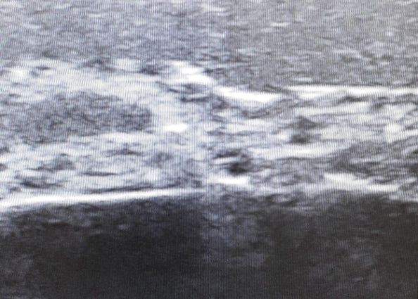 Ultrasound Simulator - Training Face — Health Simulation