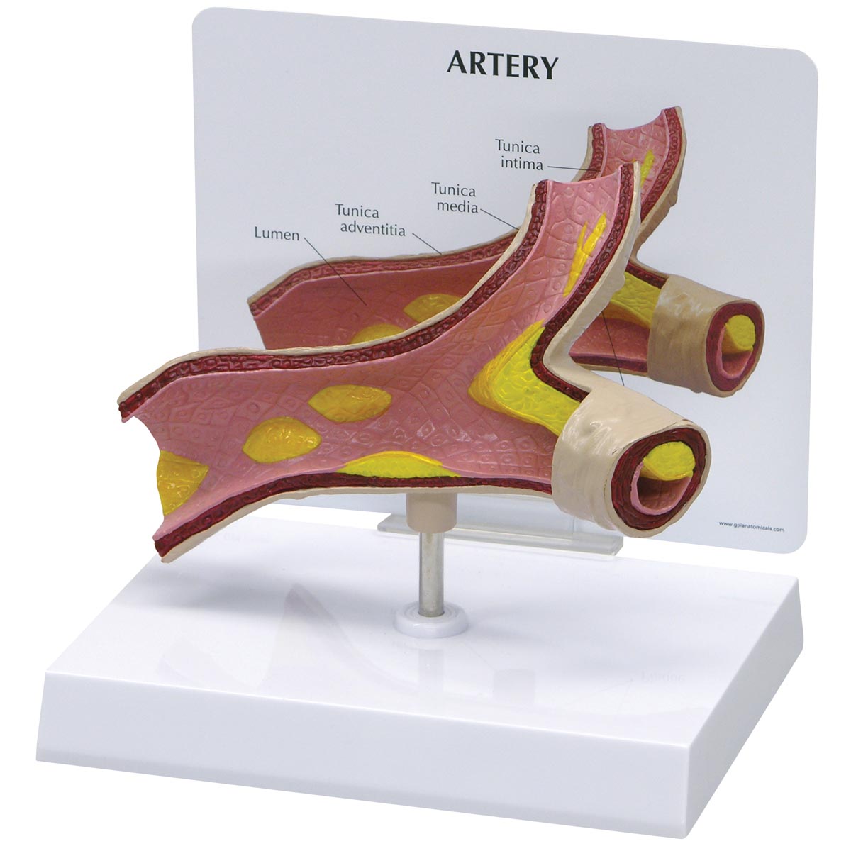 Artery Model — Health Simulation