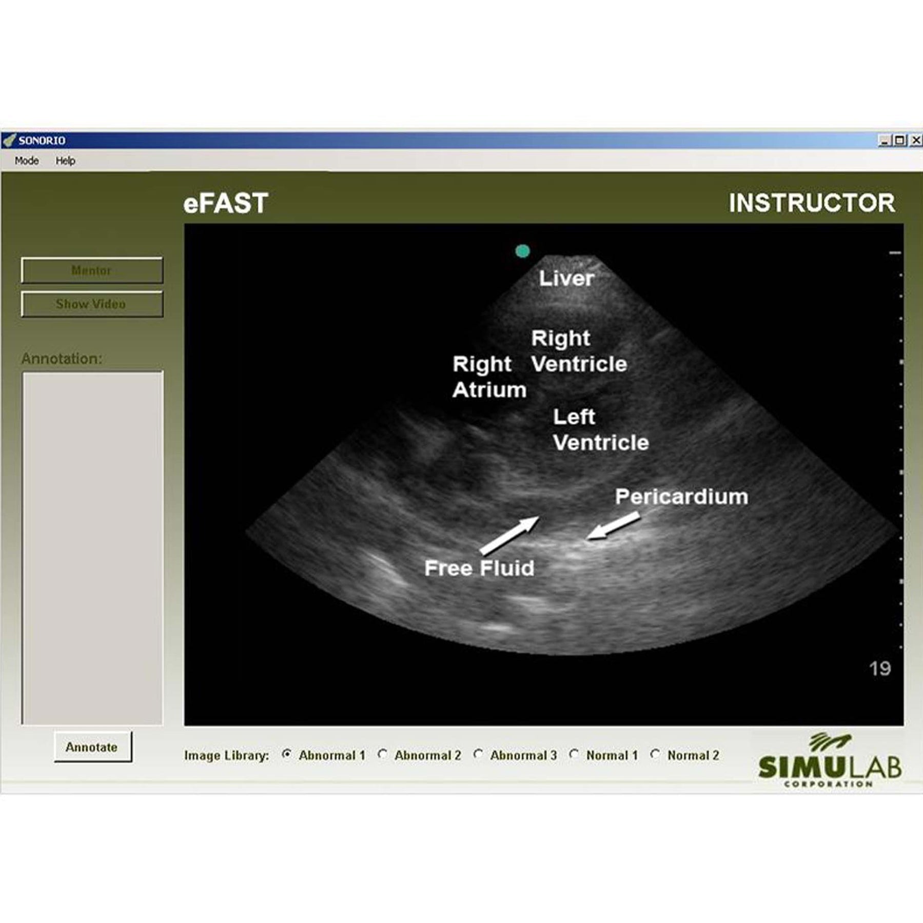 eFAST Module for SonoMan System Diagnostic Ultrasound Trainer — Health ...